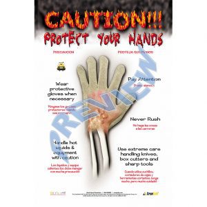 Hand Injury Prevention Poster – CrewSafe