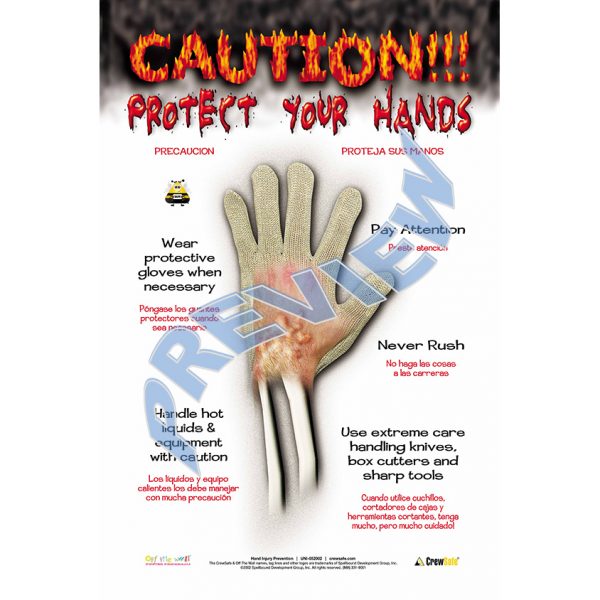 Hand Injury Prevention Poster – CrewSafe
