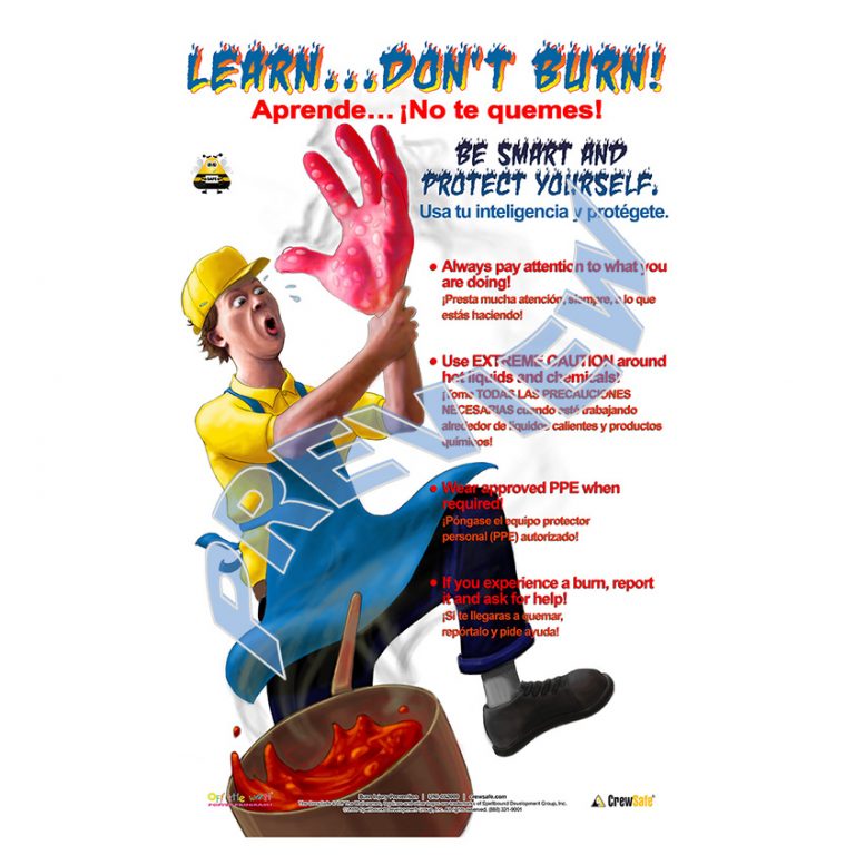 Burn Injury Prevention Poster – CrewSafe
